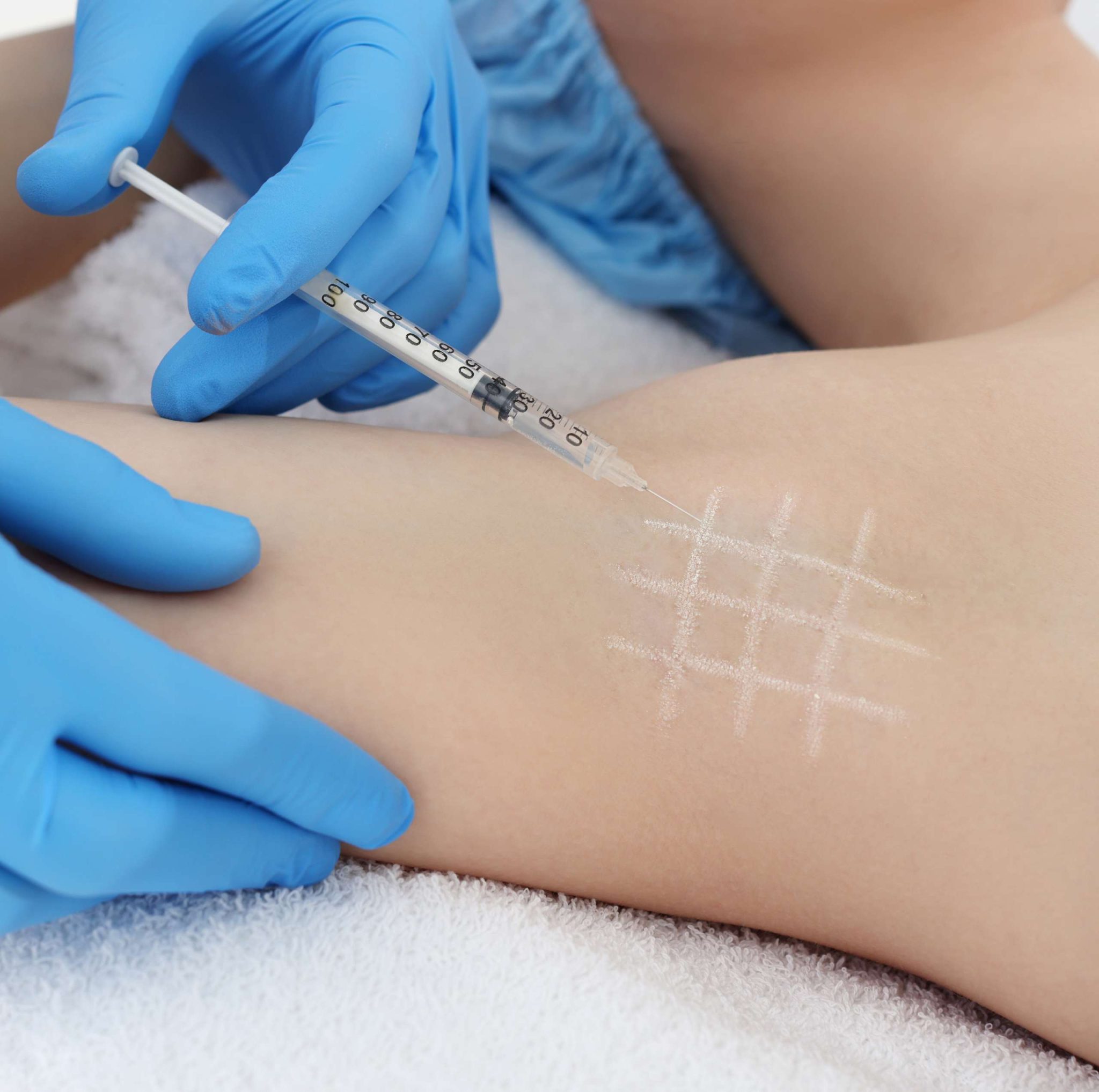 Medisinske behandlinger Trondheim - Skaanes Cosmetica